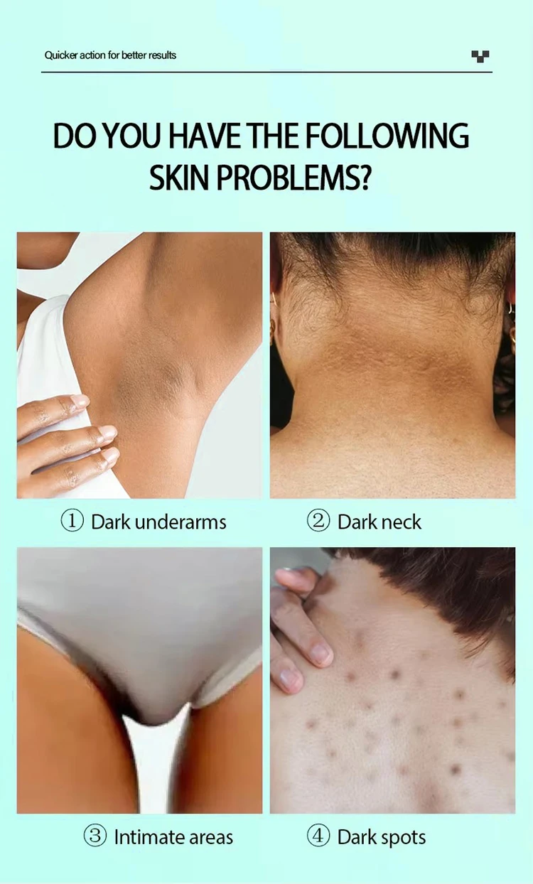 Private Label OEM Intense Whitening Cream Dark Spots Eraser Spotless ...