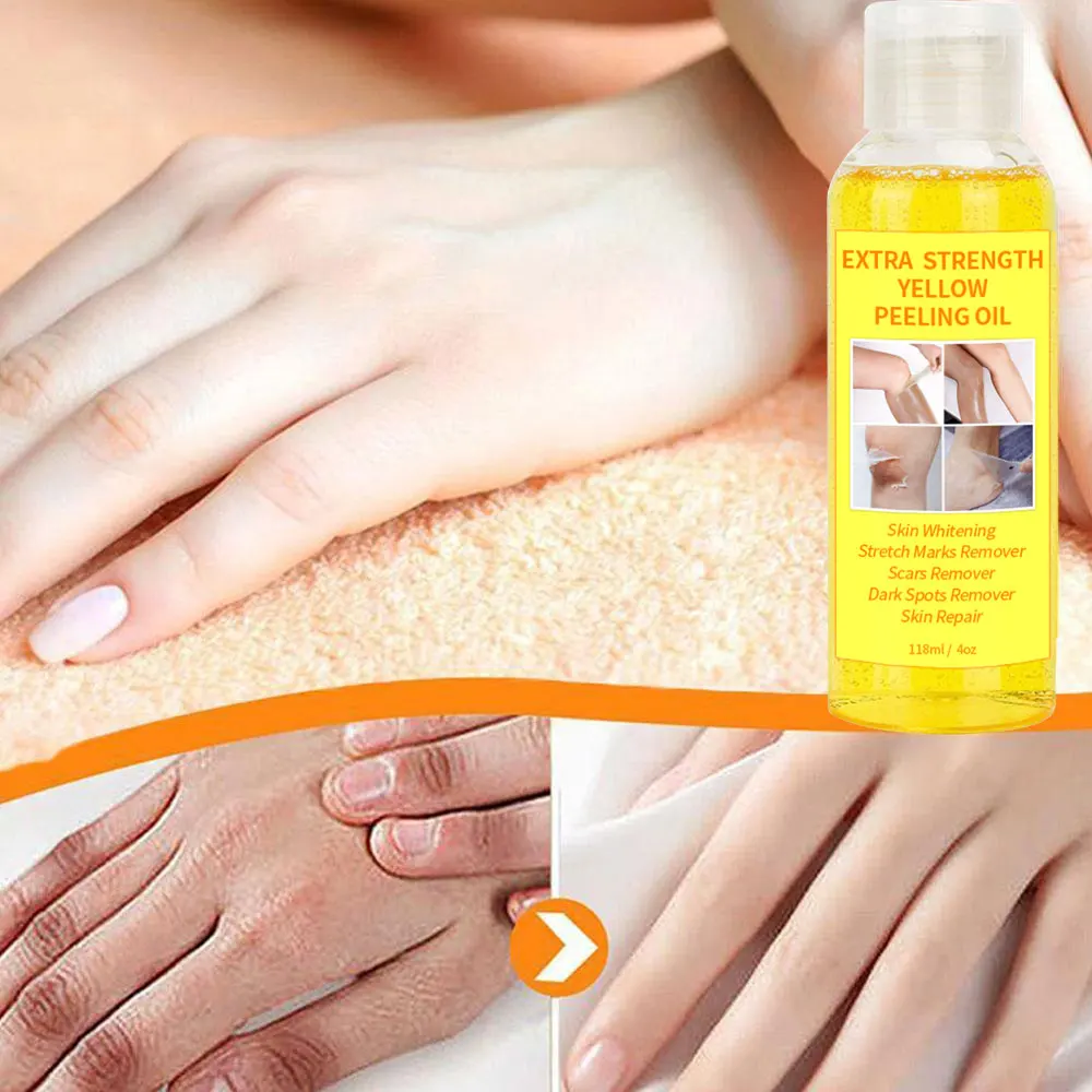 Extra Strong Peeling Oil Knuckles Skin Whitening OEM/ODM Supply Pure ...