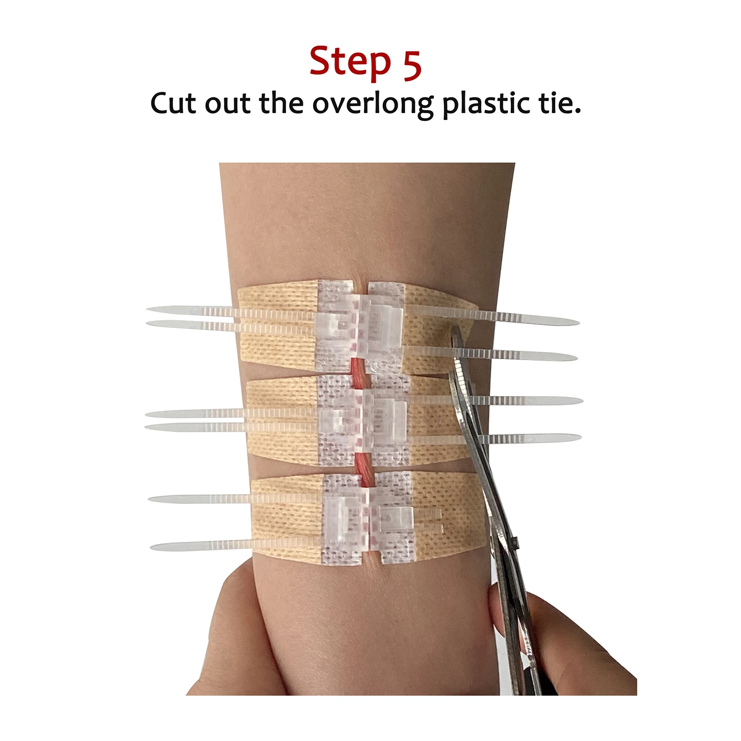 Zip Stitch Sutures - Waterproof Wound Closure Strips