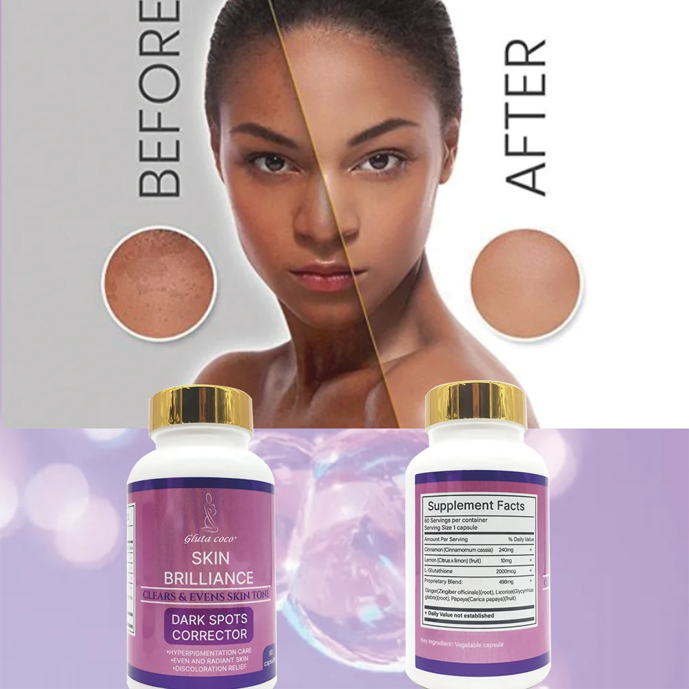 Glutathione Pills Before After