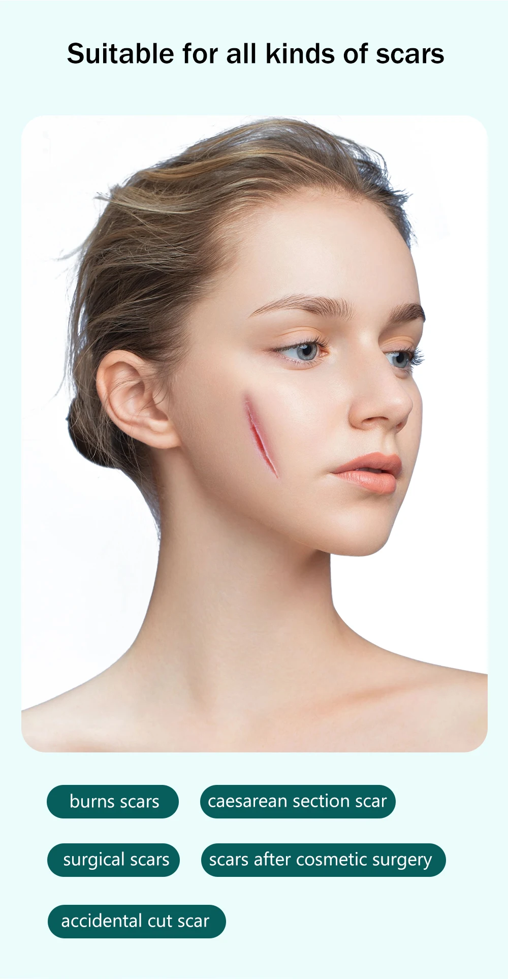 Private Label Scar Repair Gel Skin Care Fade Skin Scar Marks Skin ...