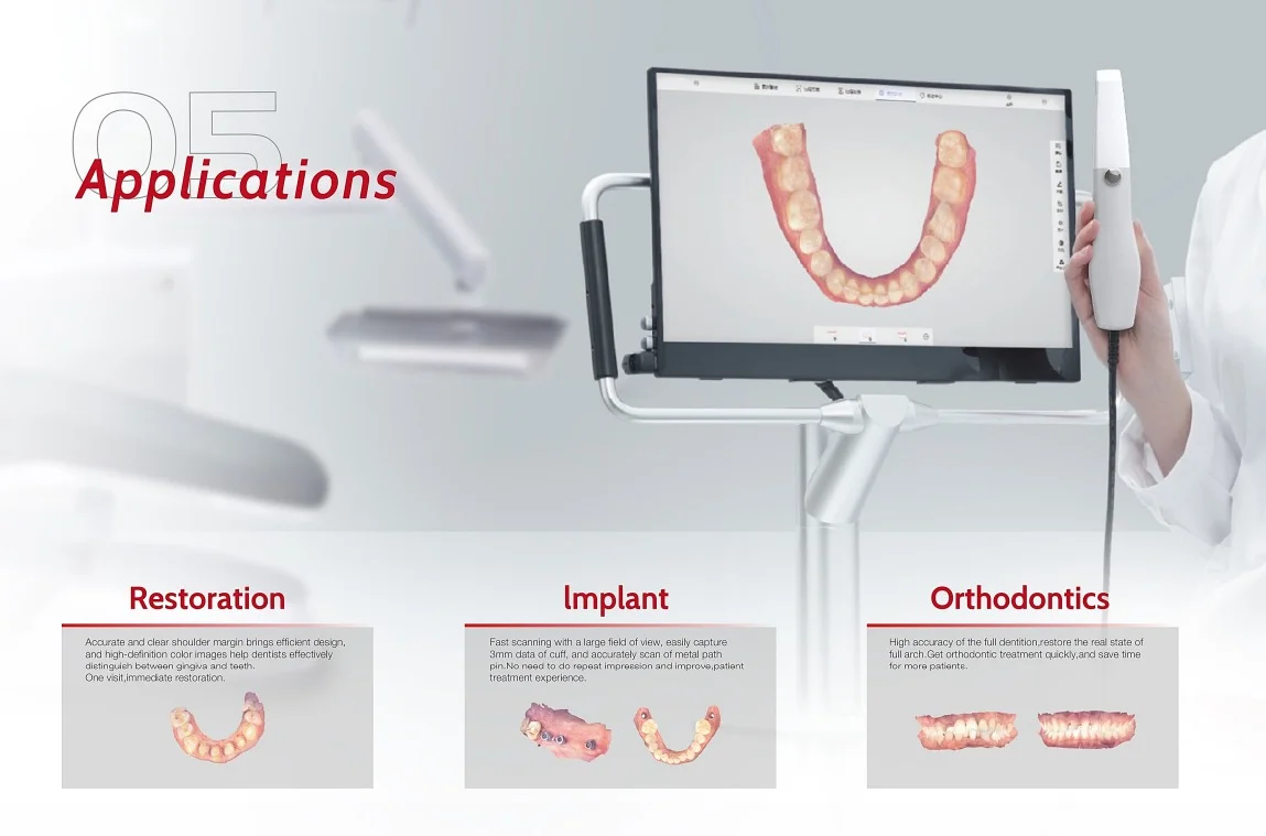 Panda P3 Intraoral Intra Oral Scanner 3d Dental With Printer - Buy ...