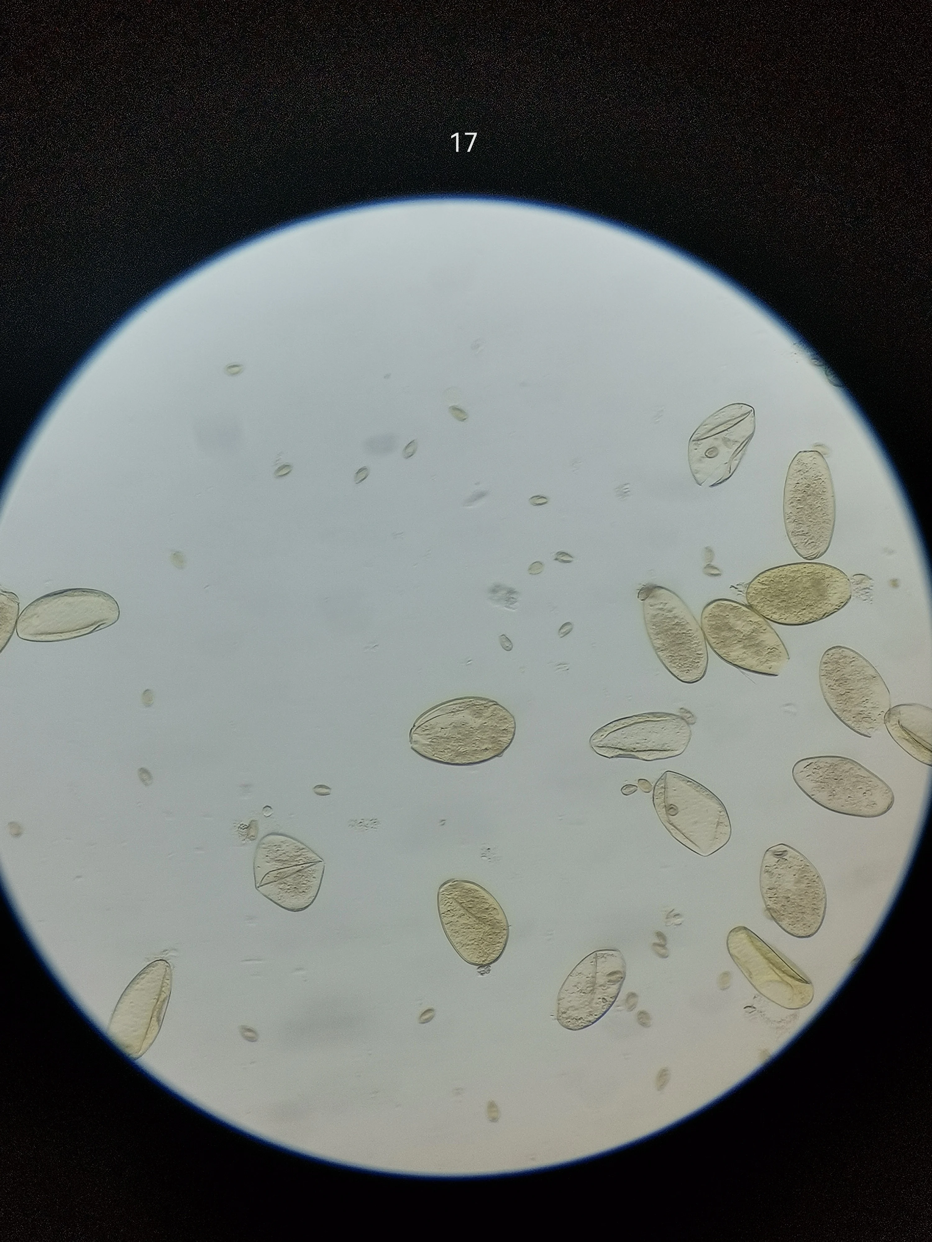 Medical Parasitology Prepared Slides for Student Learning