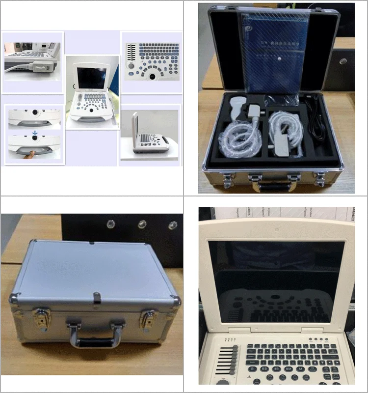 Dawei DW-580 Portable Ultrasound Machine - Reliable & Versatile