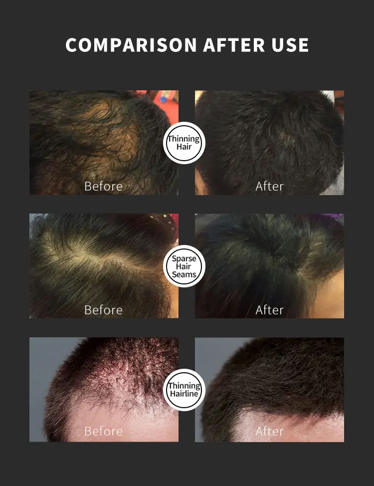 Custom Logo 27.5g Hair Fibers - Natural Thickening Solution