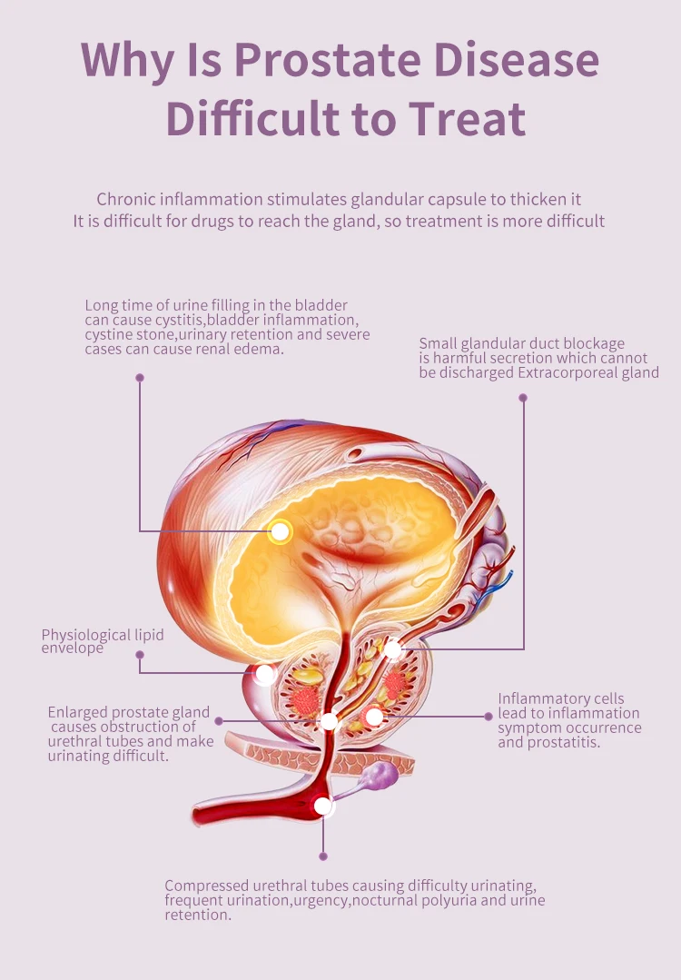 New Idea Product 2024 Home Use Red Light Physiotherapy Device Pain ...