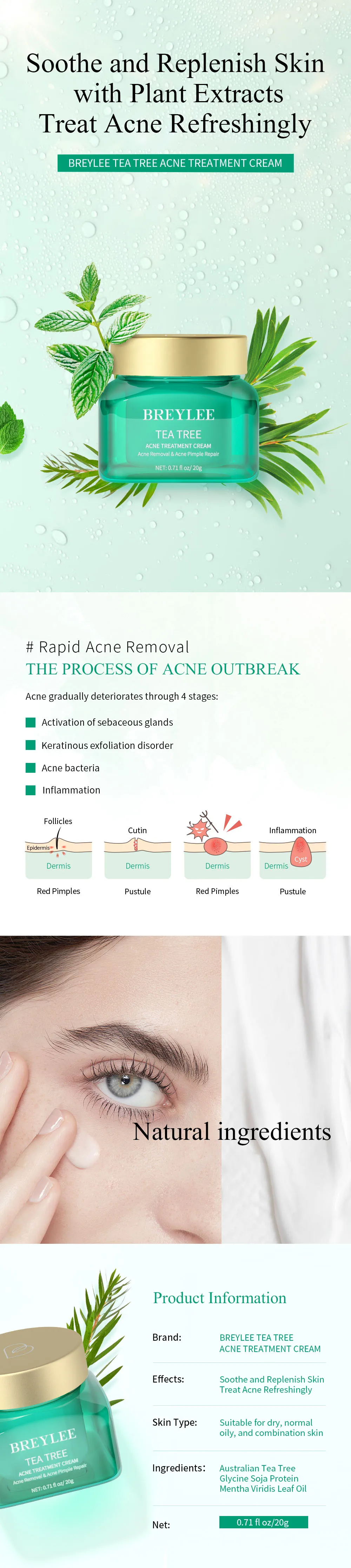 Breylee Tea Tree Essential Acne Removal Moisturizing Soothe Skin Acne ...