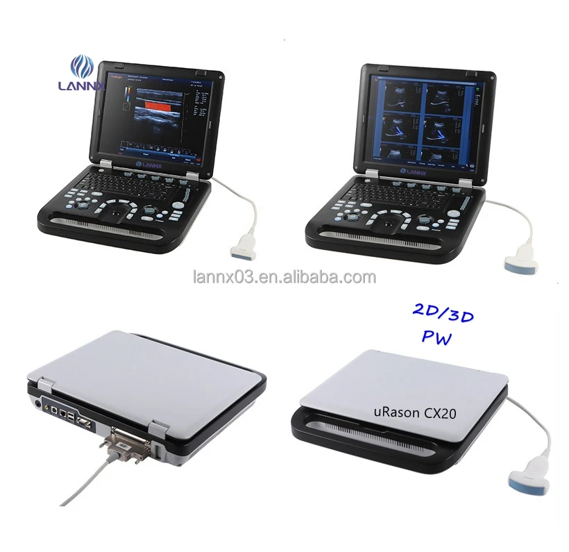 Lannx Urason Cx20 Hd Screen Laptop Digital Cardiology Ultrasound Medical 2d/3d Optional ...