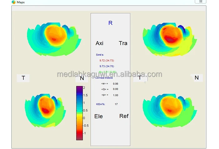 Corneal Topographer - Precision in Optometry & Ophthalmology