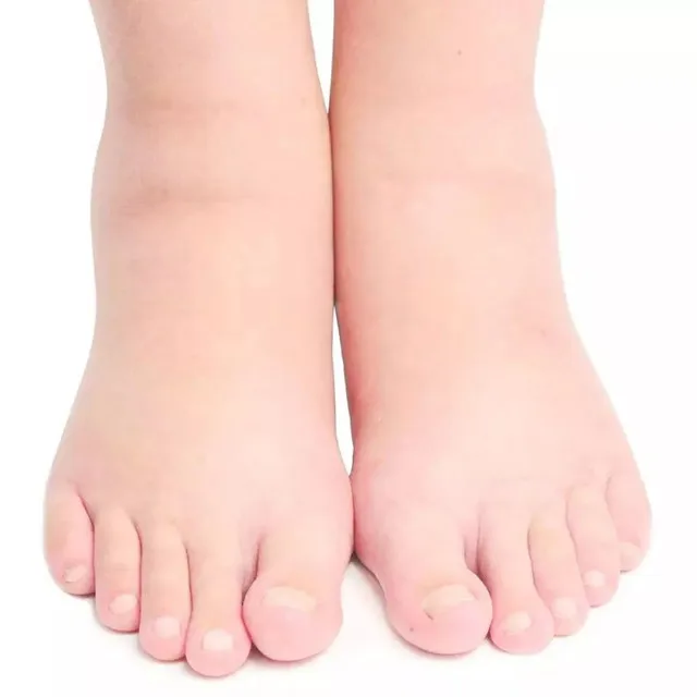 Chinese Supplement Pinus Pinaster Extract 95% Polyphenol Pine Bark ...