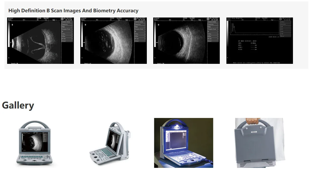 Ophthalmology Ultrasound Scanner ODU-5 Eye Diagnostic Ophthalmic AB ...