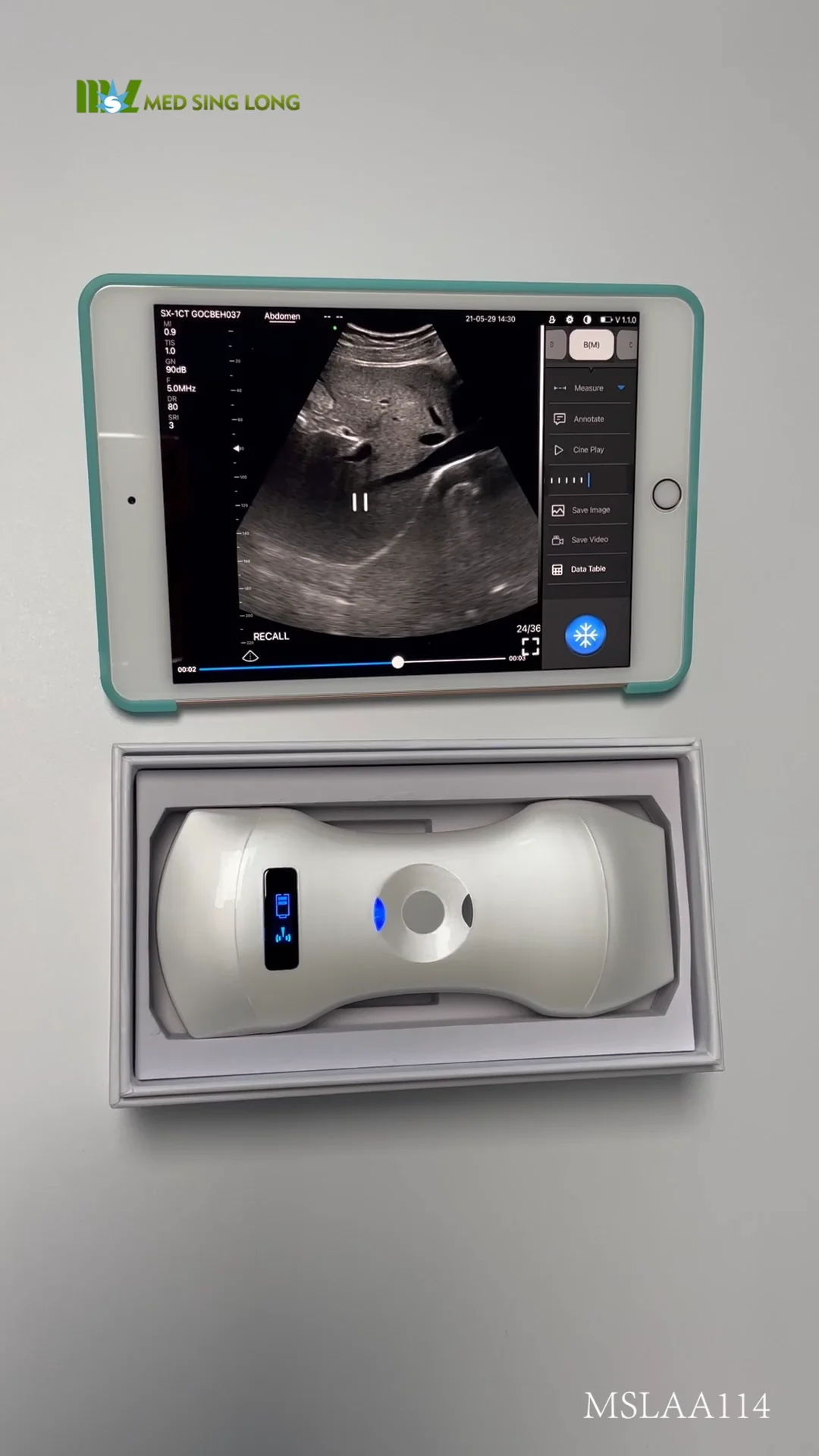 Handheld Wifi Usb Ultrasound Android 192 Elements Phased Array Cardiac ...