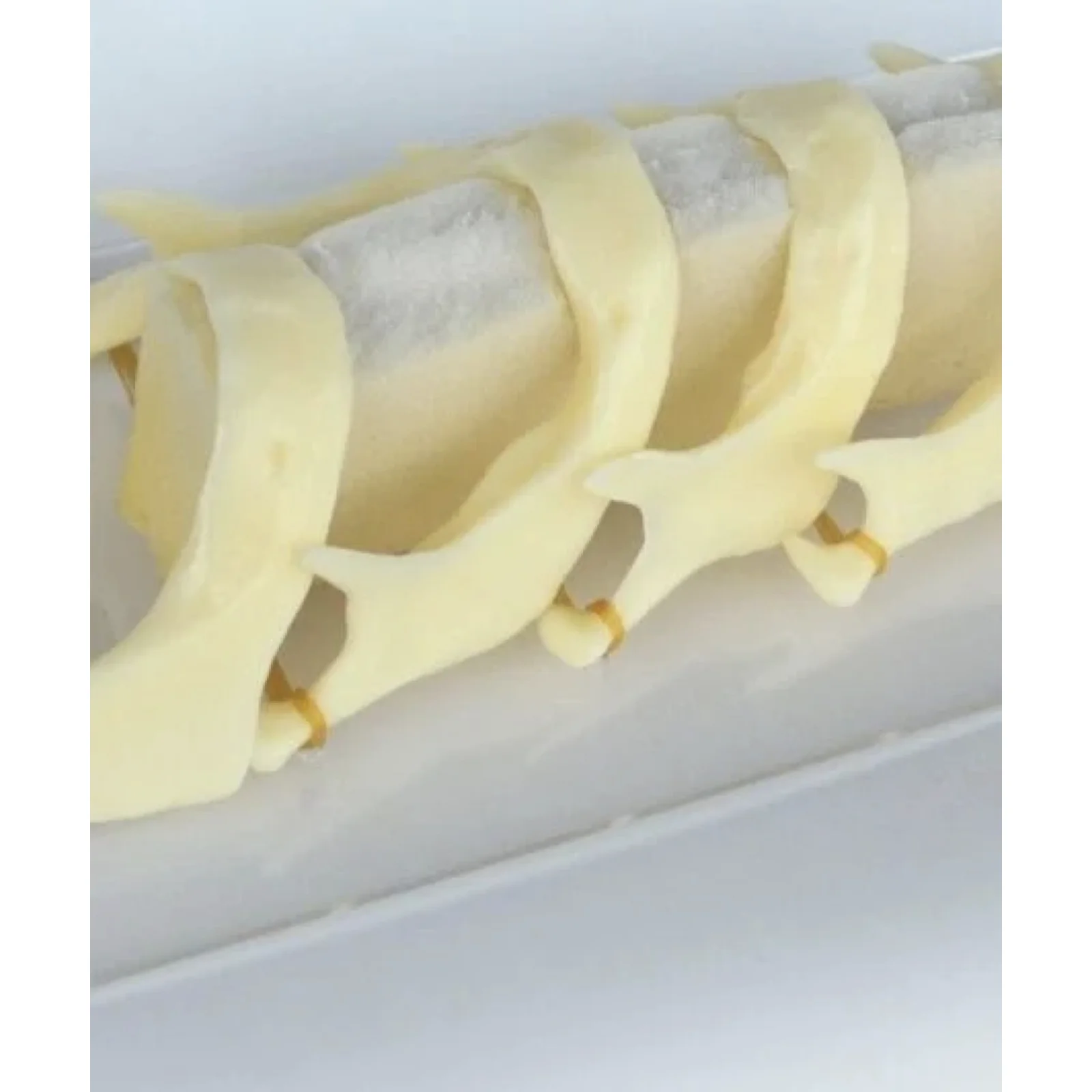 Kyrenmed Atrophied-ridge Mandibular Ble Model Set Of 5 The Development ...