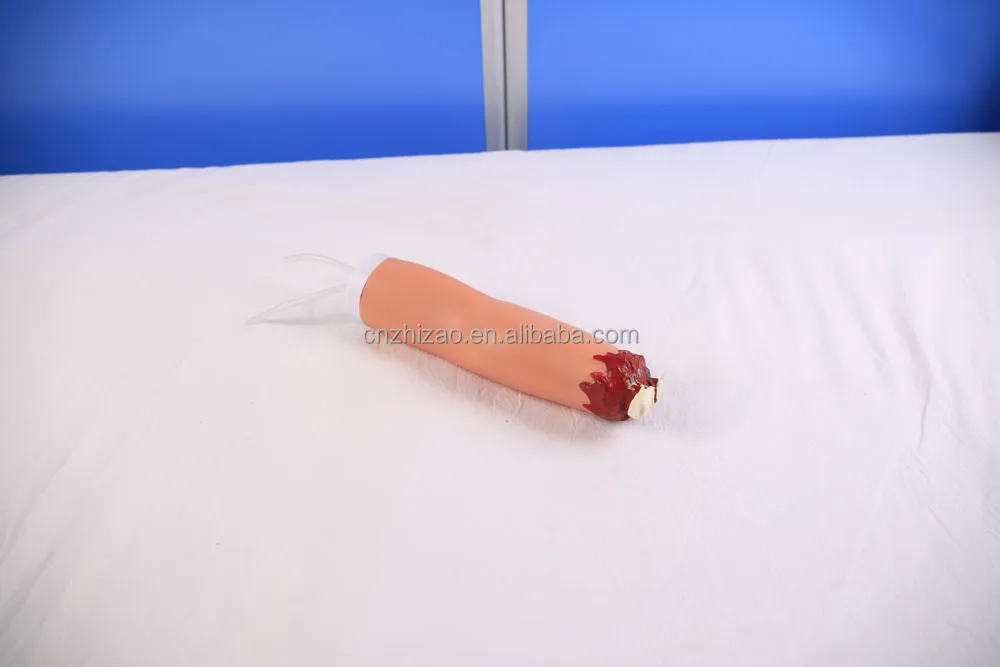 Medical Science Teahing Upper Limb Trauma Amputation and Hemostasis ...