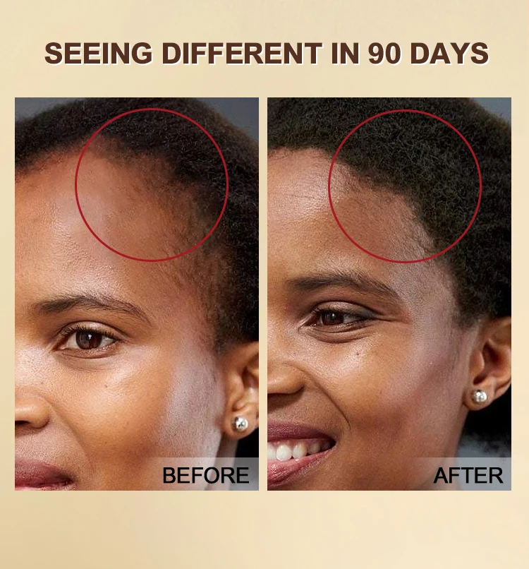 Oem Natural Castor Argan Hair Regrowth Tonics Ginger Hair Growth Oil ...