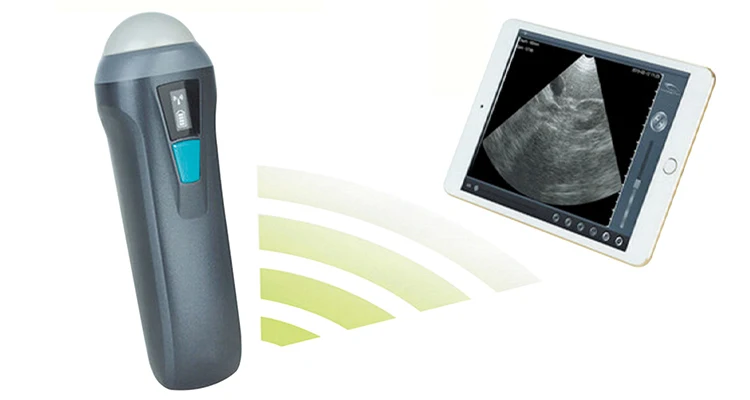 Veterinary Ultrasound Machine - Portable & Wireless Scanner