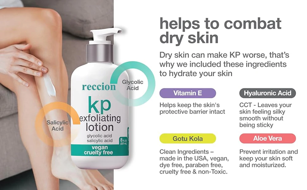 Keratosis Pilaris Body Lotion Cream 12% Glycolic Acid Lotion Aha Rough ...