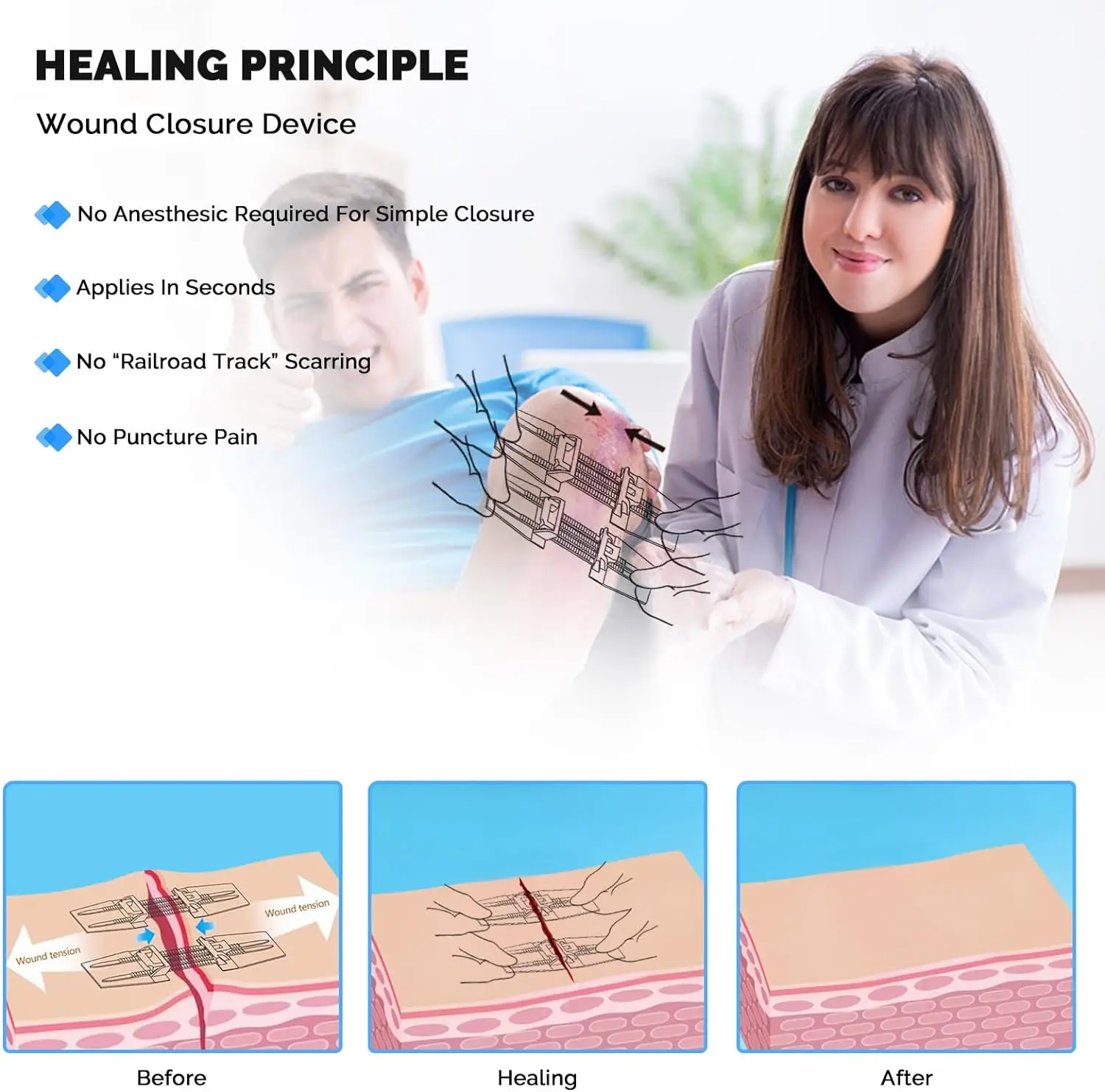 Zip Sutures Wound Closure Device(Non-Woven Fabric) Wound Care Butterfly ...