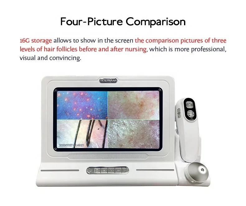 Portable Ai Intelligent Automatic Scalp Analyser - Hair Care Machine