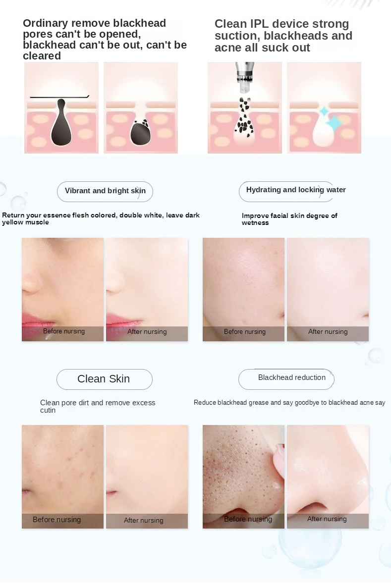 7in1 H2o2 Aqua Peeling Facial Machine Hydrogen Oxygen Jet Peel Spray ...