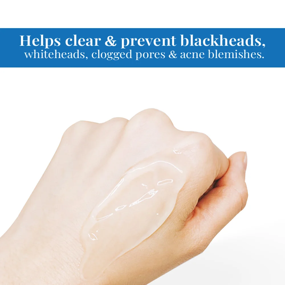 Acne Spot Gel Oil-Free Succinct Acid Strength Acne Cream