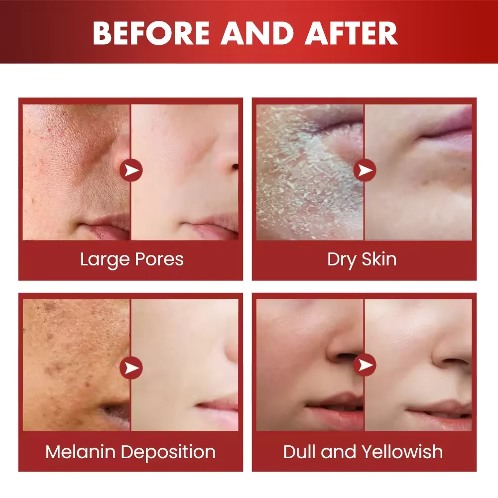 TWG Retinol Placenta Royal Dragon Blood Whitening Face Cream ...