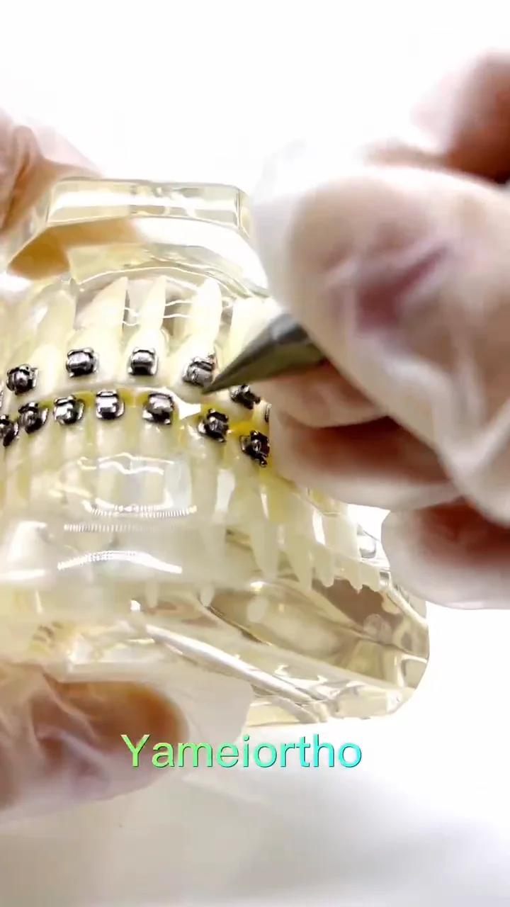Dental Bracket AZDENT Self-Ligating Orthodontic Brackets With Buccal ...