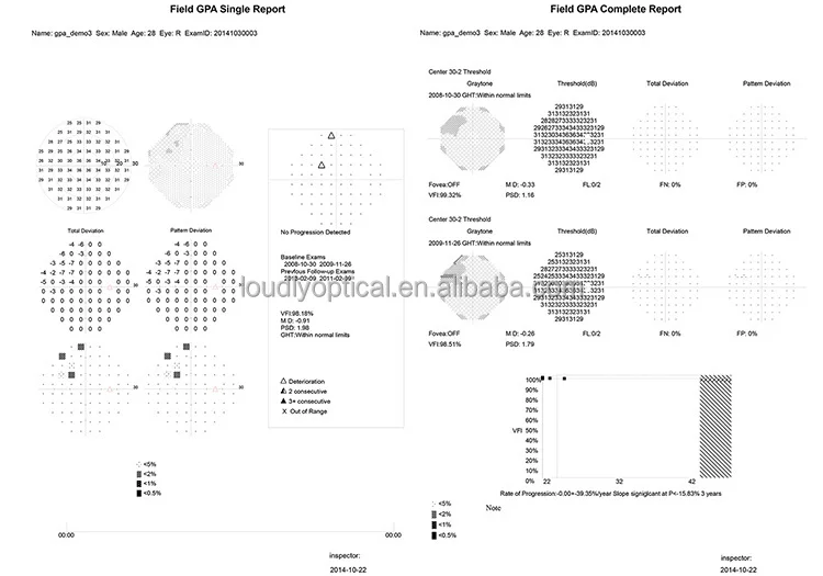 High Quality Visual Field Perimeter - APS-T90 Ophthalmic Instrument