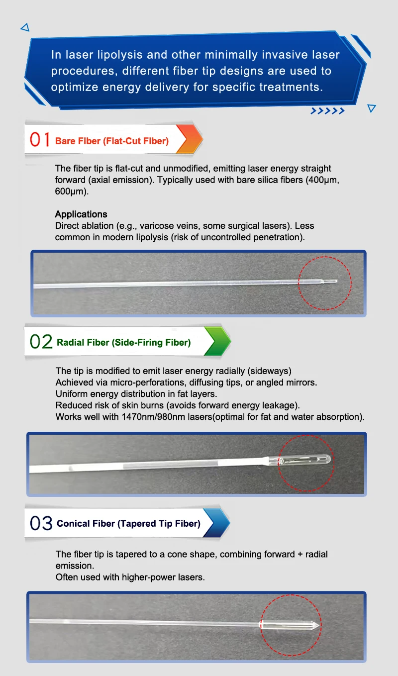 SMA905 Radial/tip/bare Fibers Medical Surgery Laser Fibers and ...