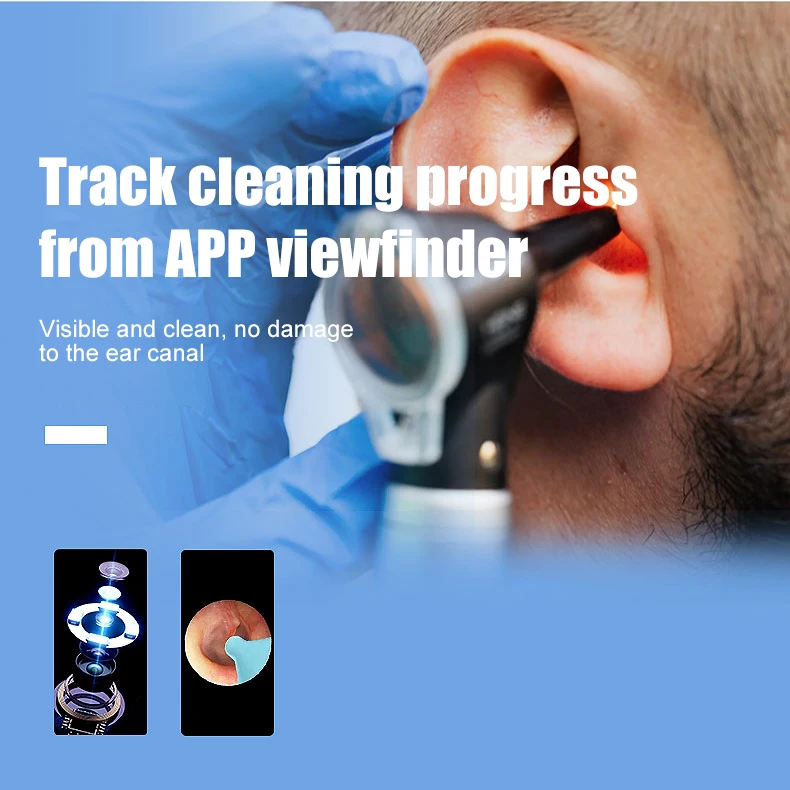 Visual Ear Cleaning Tool - Smart Otoscope Kit with Camera