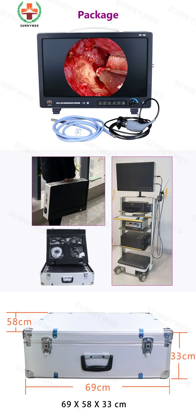 Sunnymed 1080p Medical Endoscopy Camera - Full HD Quality