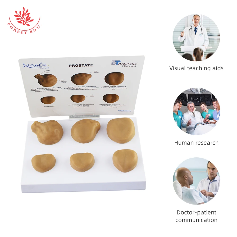 Male Prostate Anatomical Model - Medical Training Aid