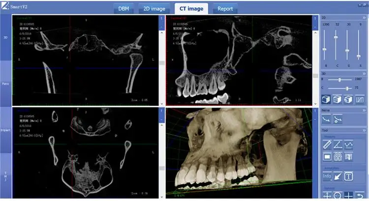 High Quality Frequency Panoramic & Cbct Digital Dental X-ray Machine Dx16 - Buy Cbct Dental ...
