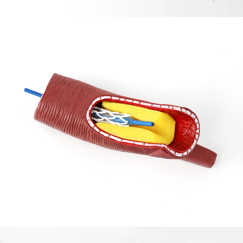 Vascular Stent Model Human Vascular Model Medical Human Teaching ...