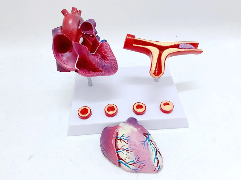 Anatomical Heart Model - Educational Tool for Medical Science