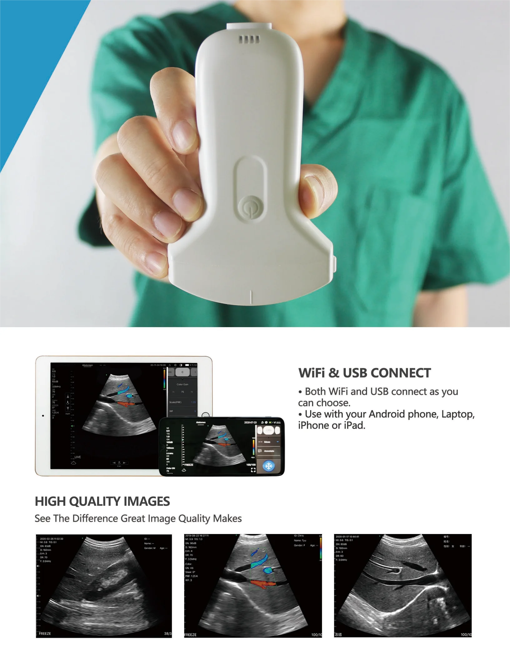 Portable Abdominal Probe Handheld Curve Probe Ultrasound Transducer ...