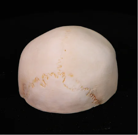 ECDH 3D Printing Model Human Skull Cap for Anatomy Learning