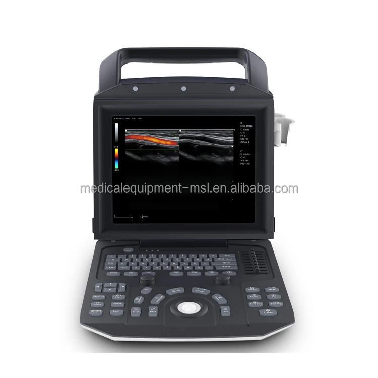 Portable Color Doppler 3D 4D Ultrasound Machine - Full Digital
