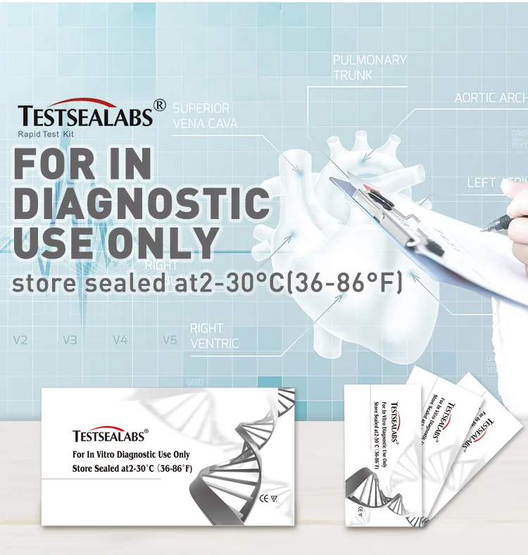 Carcinoma Embryonic Antigen Tumor Markers Cea Fecal Occult Blood Fob ...