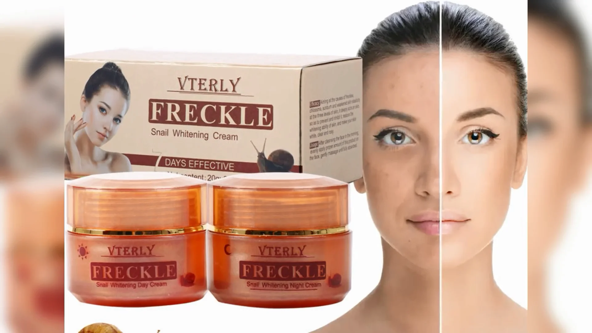 Pimples Melasma Blemish Removal Dark Spot Remover Cream Strong Face ...