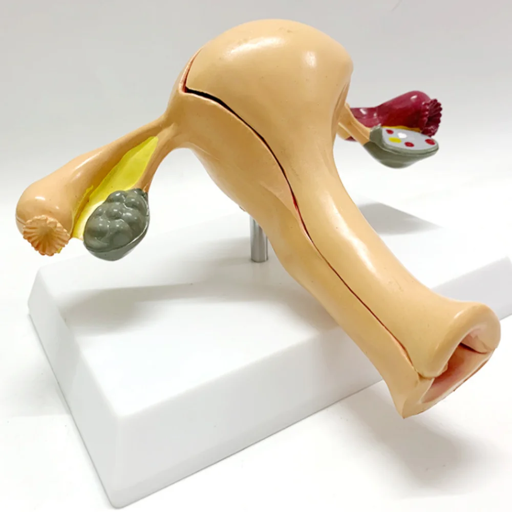 High Quality PVC Plastic Anatomy Model of Female Uterus