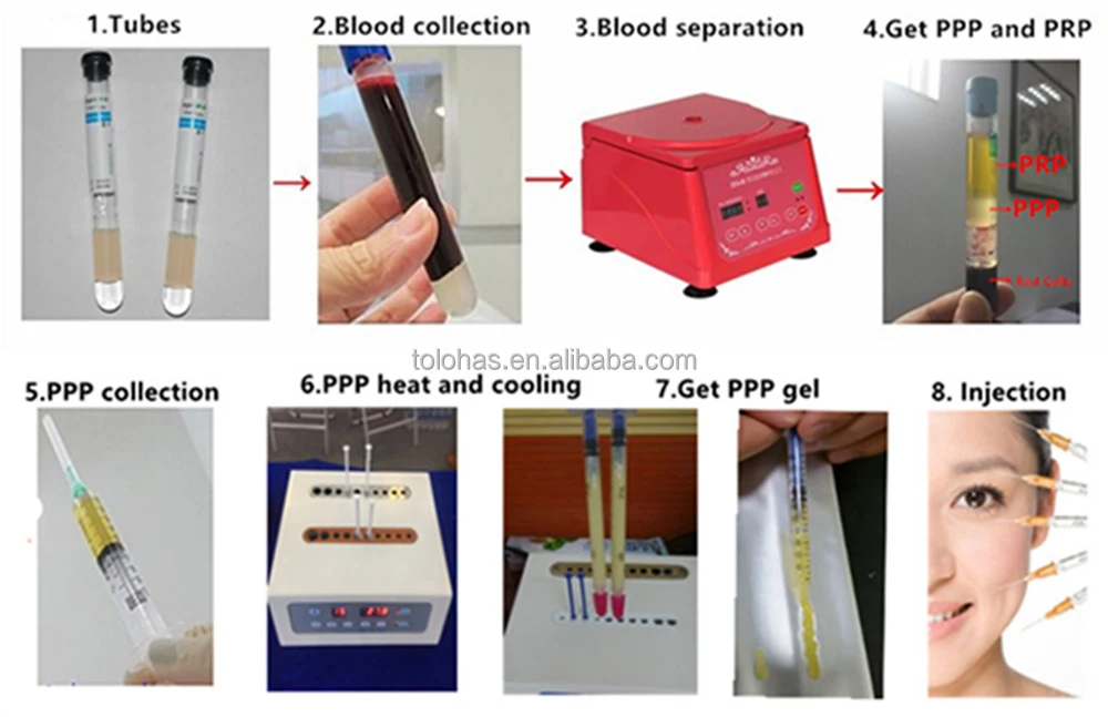 LHSGM Bio Filler Machine - Plasma Gel Maker for Aesthetics
