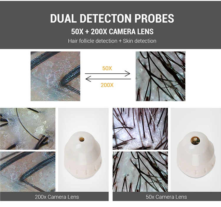 Portable HD Permanent Hair Straightening Price Follicle And Scalp ...