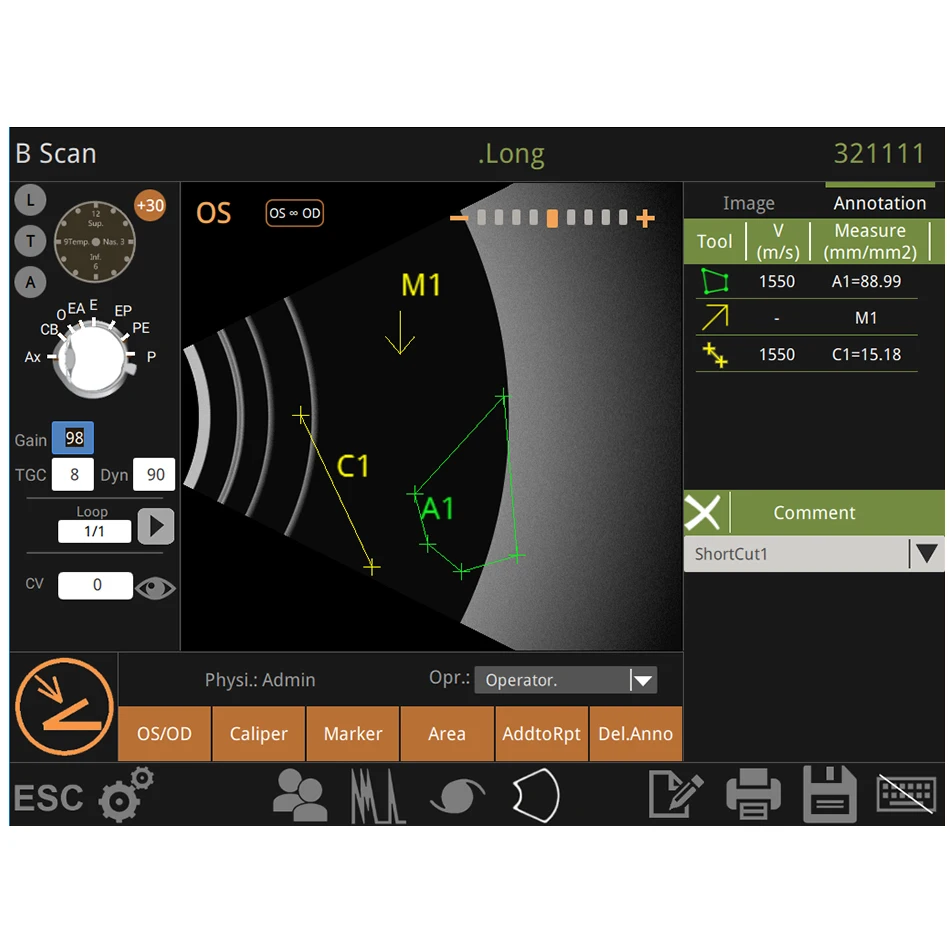 便携式眼科生物医学A扫描和眼科超声B扫描眼科扫描仪盒出售RW-1000| Alibaba.com