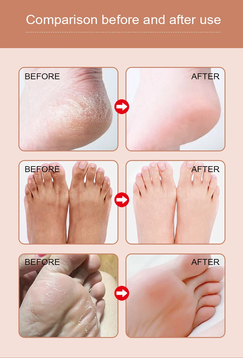 Jelly Foot Soak Jelly Pedicure Foot Spa Care Pack Soak Bath Gel ...