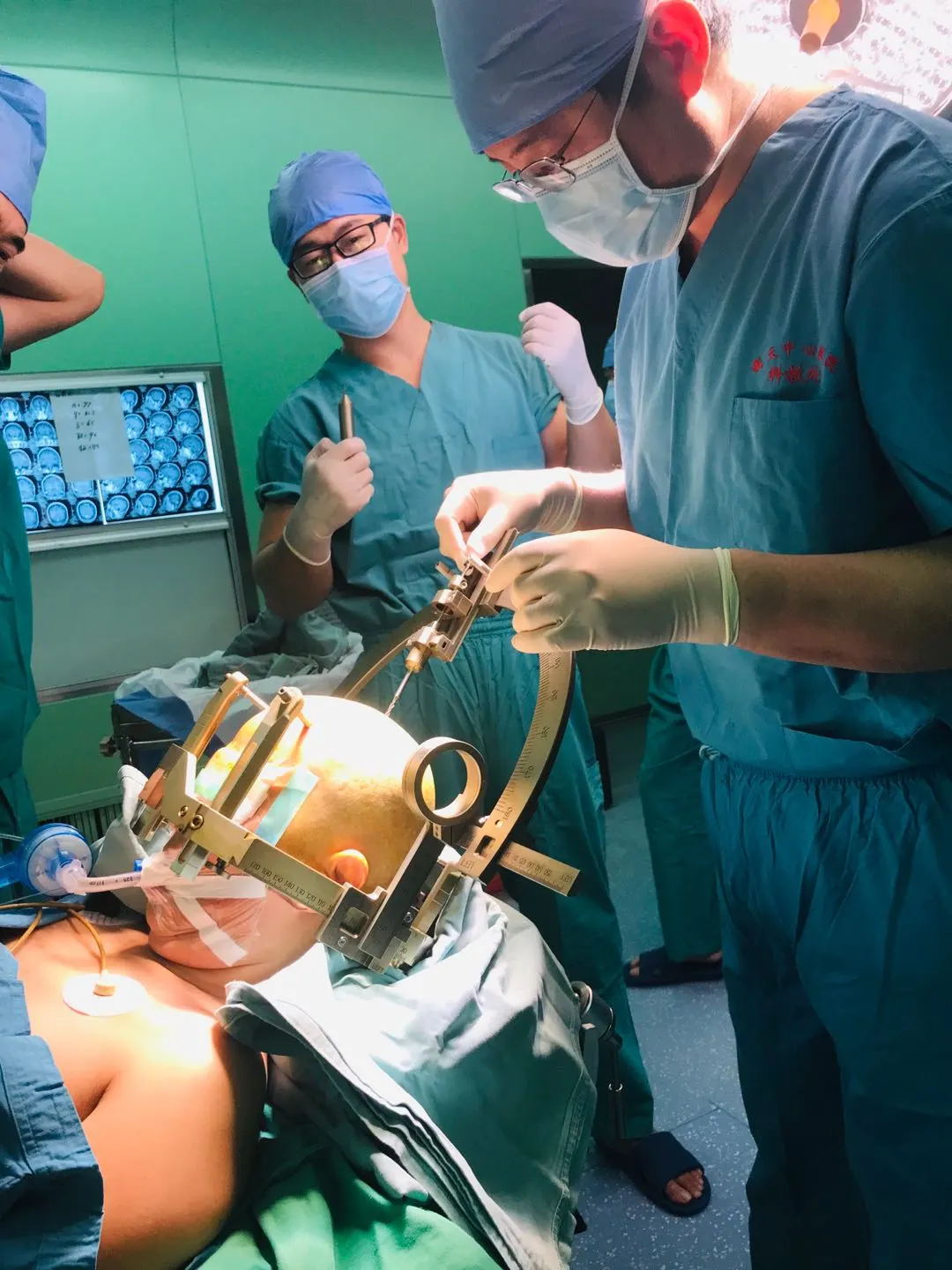 Brain Surgery Surgical Instruments Neurosurgery Brain Stereotaxic Head ...