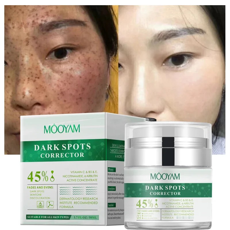 OEM Wholesale Private Label MOOYAM Skin Care Whitening Skin Beautiful ...