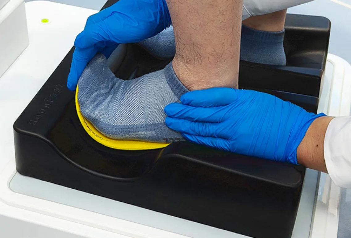 Customizable Heat Mouldable Insoles for Flat Feet Support