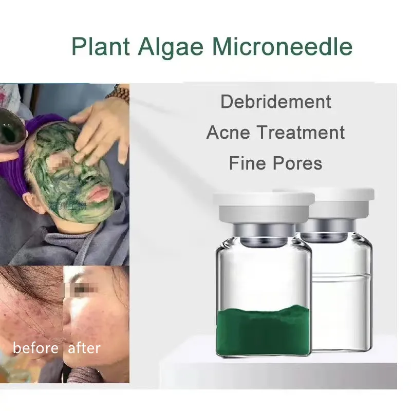 2023z Newest Sponge Microneedle Peel for Acne Treatment