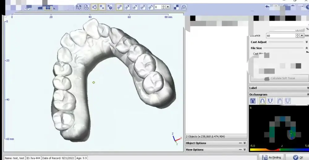 LODDEN Cad Cam Automated Aligner Trimming Machine T1 Dental Cast ...